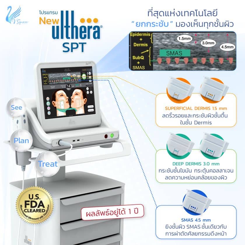 ทำ Ulthera (อัลเทอร่า) ขั้นตอนการทำ ยกกระชับ ตำแหน่งไหนได้บ้าง ? กี่วัน ...