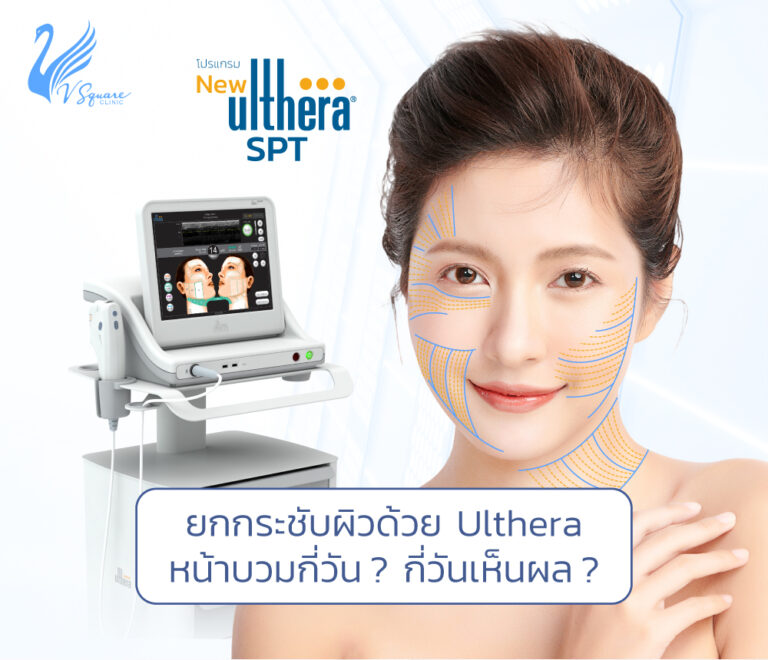 ทำ Ulthera (อัลเทอร่า) ขั้นตอนการทำ ยกกระชับ ตำแหน่งไหนได้บ้าง ? กี่วันเห็นผล