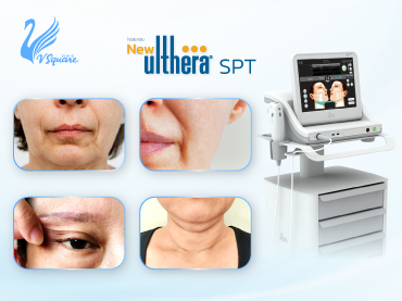 [แนะนำ 2025] Ulthera SPT เทคนิคใหม่ยกกระชับ ปรับหน้าเรียว ลดริ้วรอย ไม่ ...