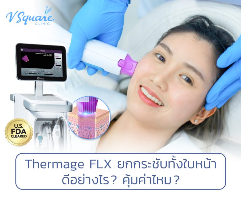 Thermage FLX ยกผิวทั้งใบหน้า ทำกี่ช็อต ราคาเท่าไหร่ ช่วยอะไรได้บ้าง