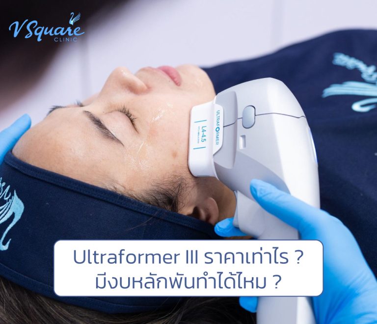 Ultraformer III ราคา 2025 งบหลักพัน ! ยกหน้าตึงเรียวเล็ก ผิวเด็ก เนียน ใส