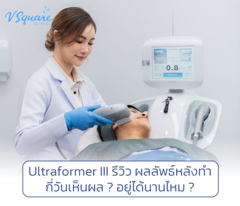 Ultraformer III รีวิวจากผู้ใช้งานจริง กับผลลัพธ์ที่คุณไม่คาดคิด