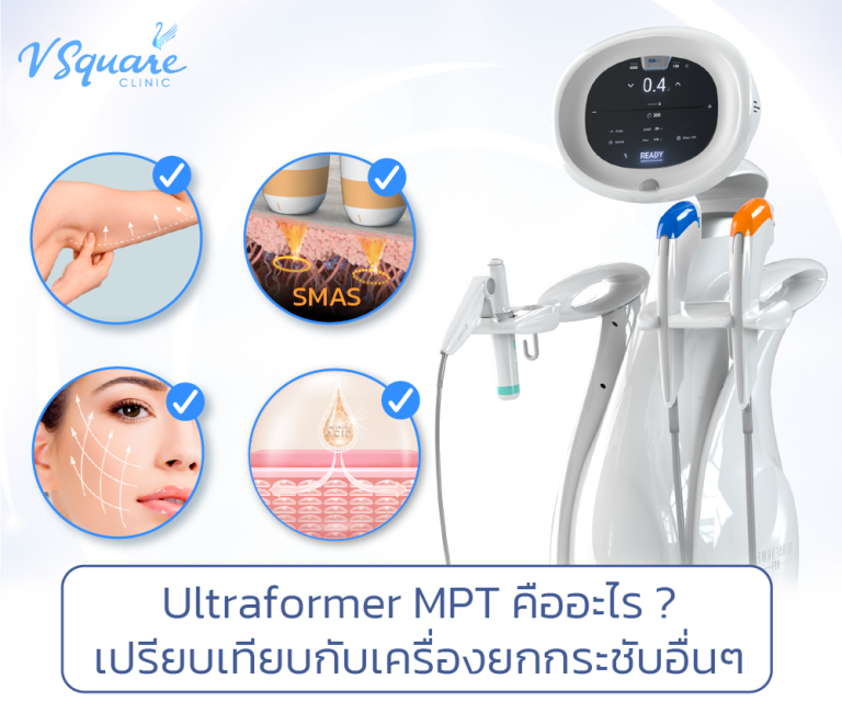 Ultraformer MPT คืออะไร ดีไหม ? อัปเดตล่าสุด ! รวมเรื่องต้องรู้ก่อนทำ